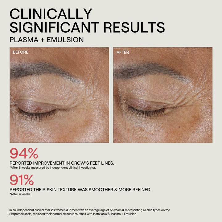 InstaFacial® Collection | Plasma + Infusion + Emulsion – Dr. Diamond's ...